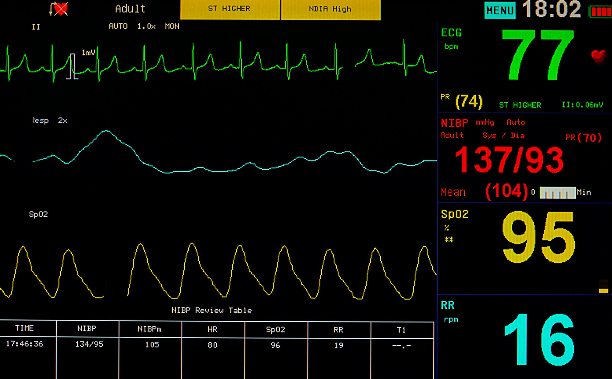 Signal-to-Noise Ratio in Medical Device Design - Research Collective